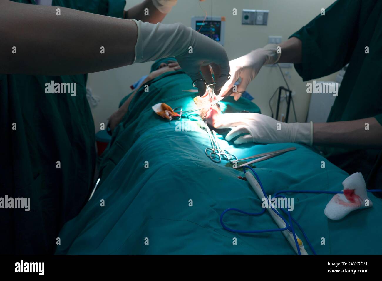 Midsection of surgery team operating Medical Team Performing Surgical ...