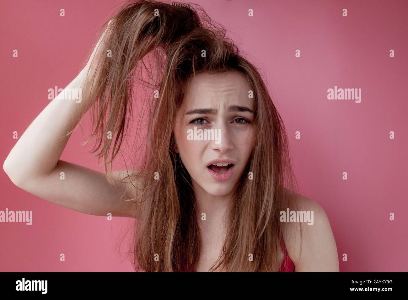 Problem scalp, greasy dirty hair girl, haircare concept Stock Photo - Alamy