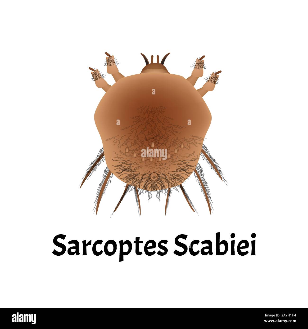 Sarcoptes scabiei. scabies. Sexually transmitted disease. Infographics ...