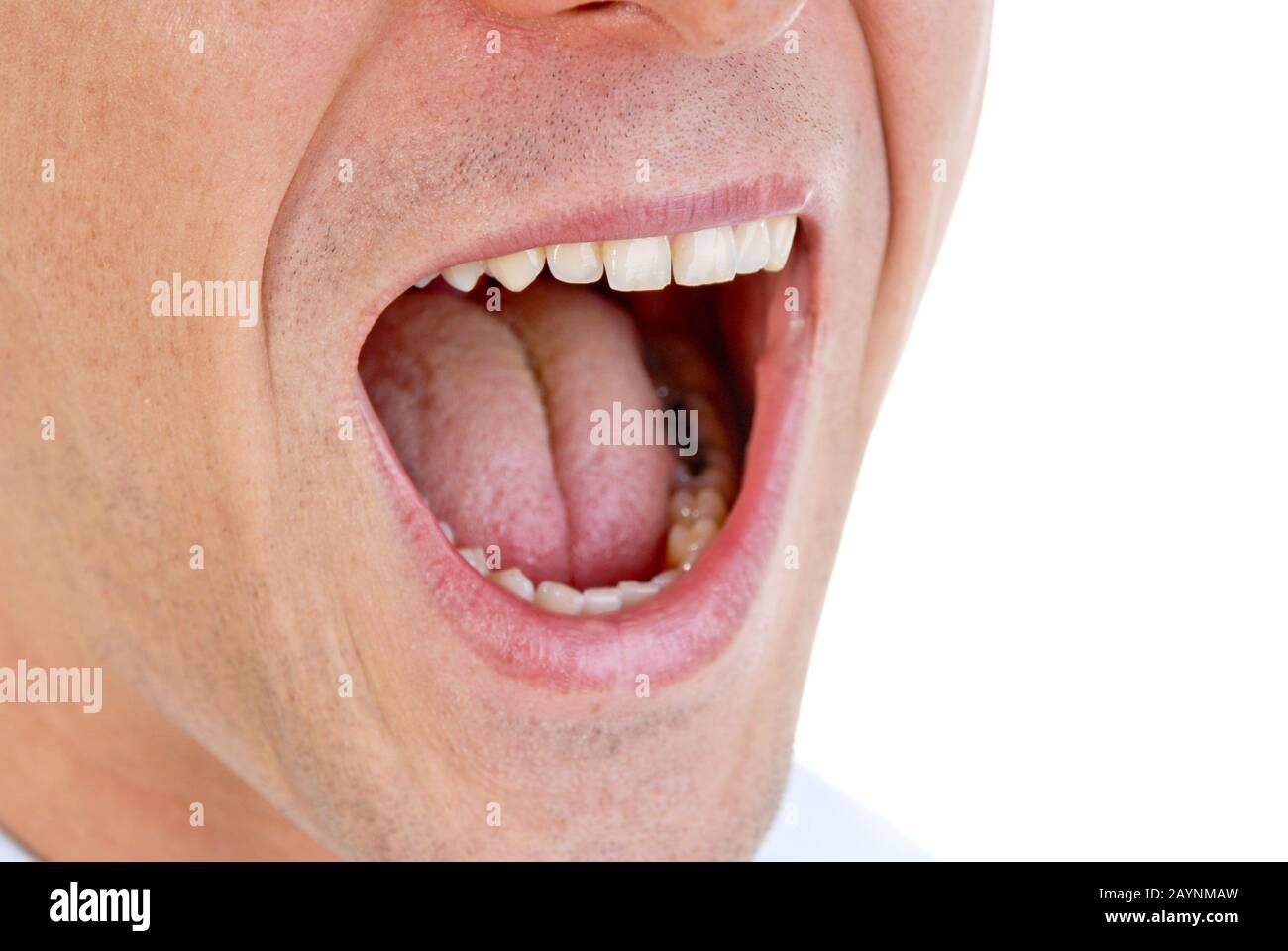 Mund offen lachen hi-res stock photography and images - Alamy