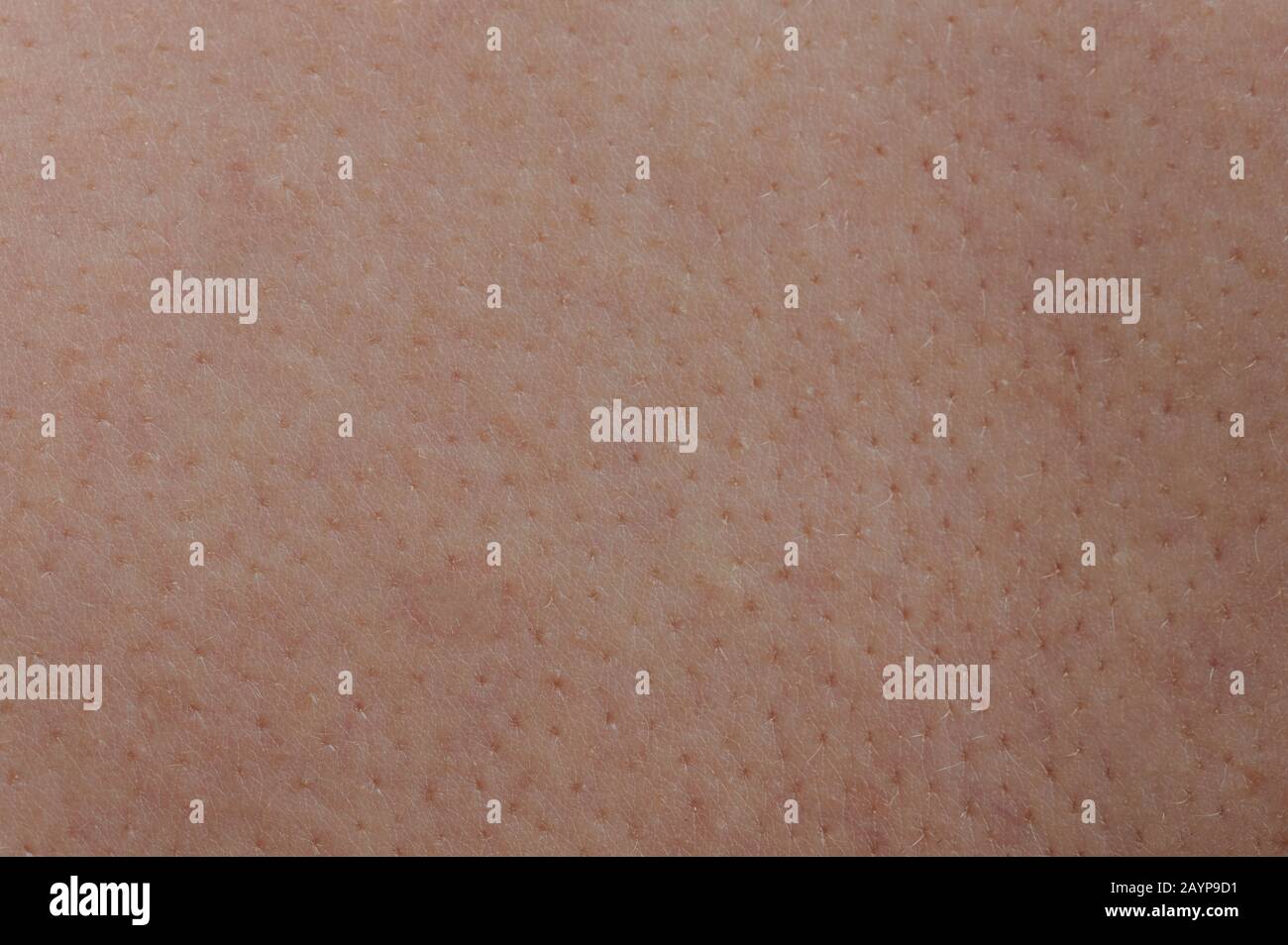 Dry human skin texture close up macro view Stock Photo - Alamy