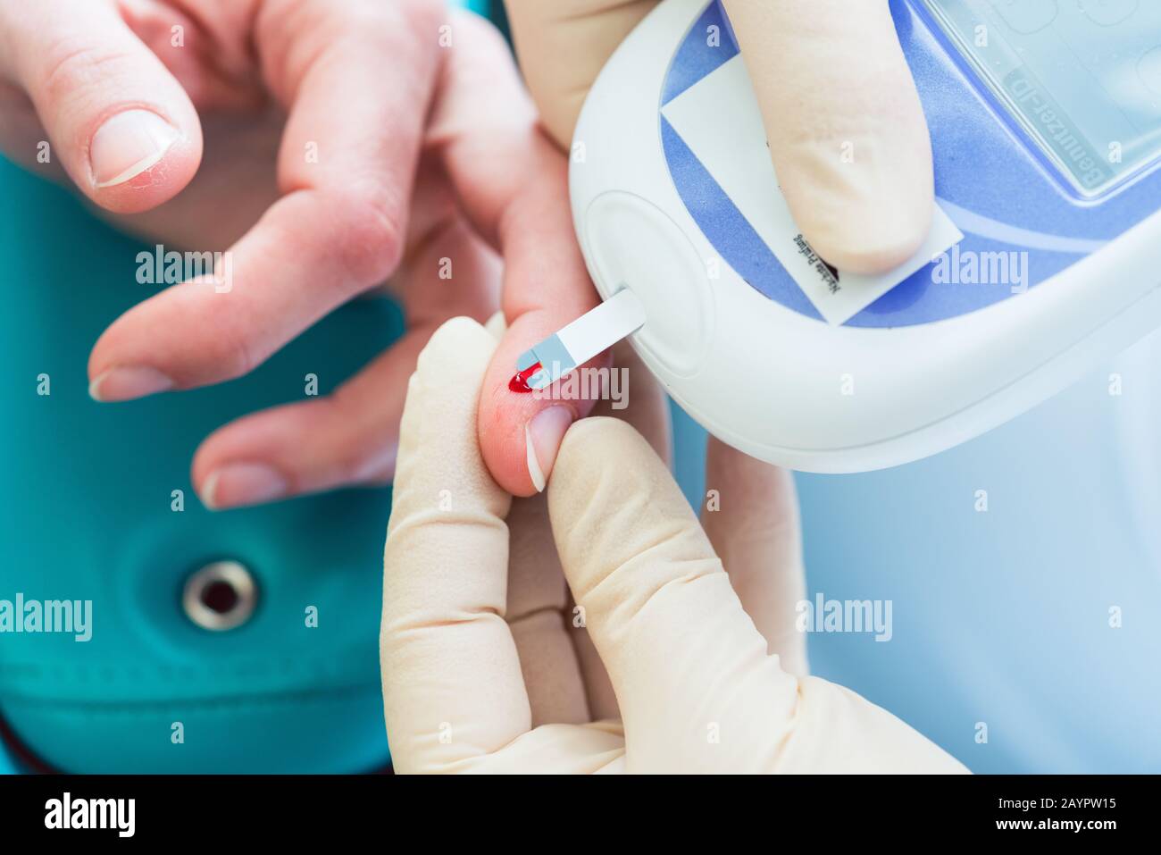 Diabetes test hi-res stock photography and images - Alamy