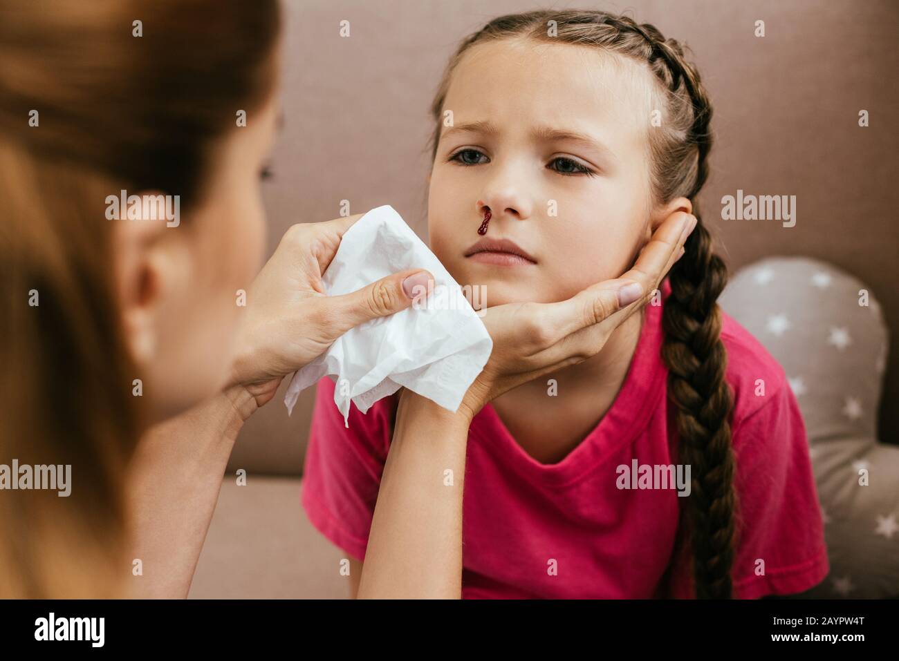 cropped view of mother holding napkin near daughter with nasal bleeding ...