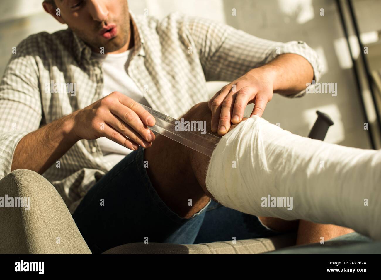 Selective focus of exited man scratching leg in plaster bandage with ...