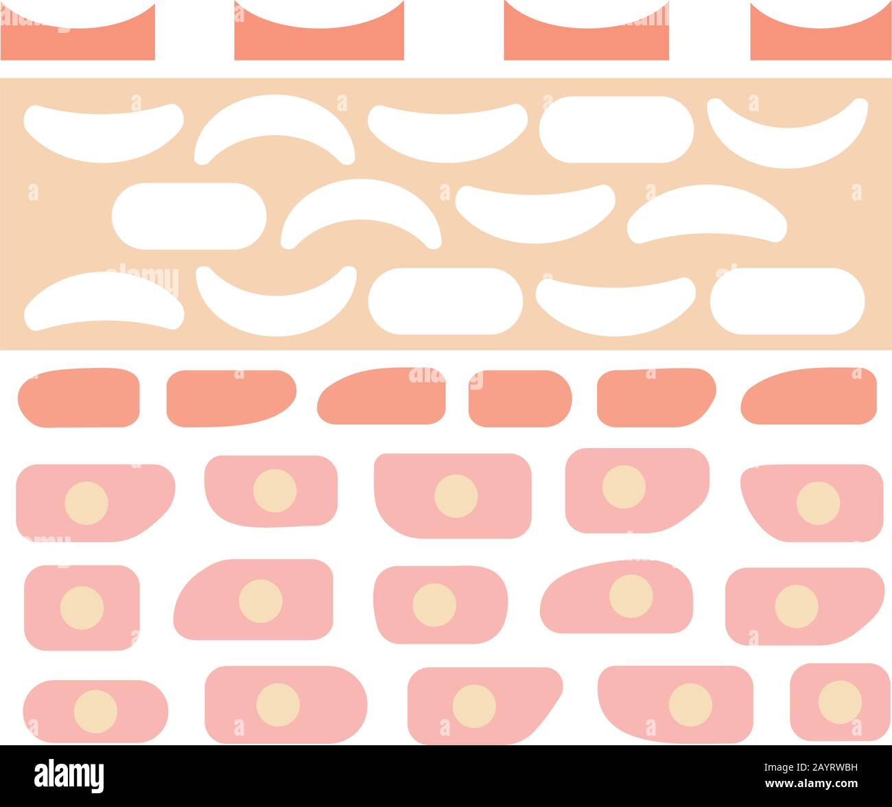 Sectional view of the skin / wounded skin Stock Vector Image & Art - Alamy