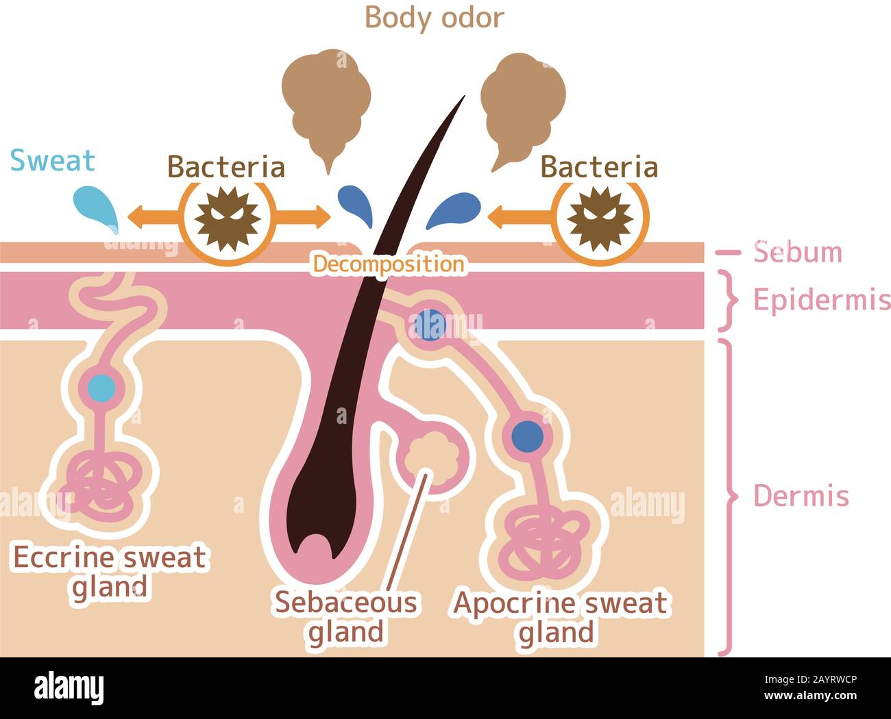 Cause of body odor vector flat illustration Stock Vector Image & Art ...
