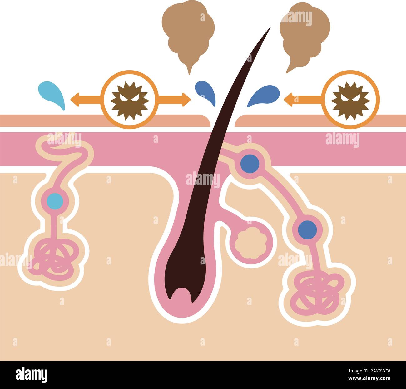 Cause of body odor vector flat illustration Stock Vector Image & Art ...