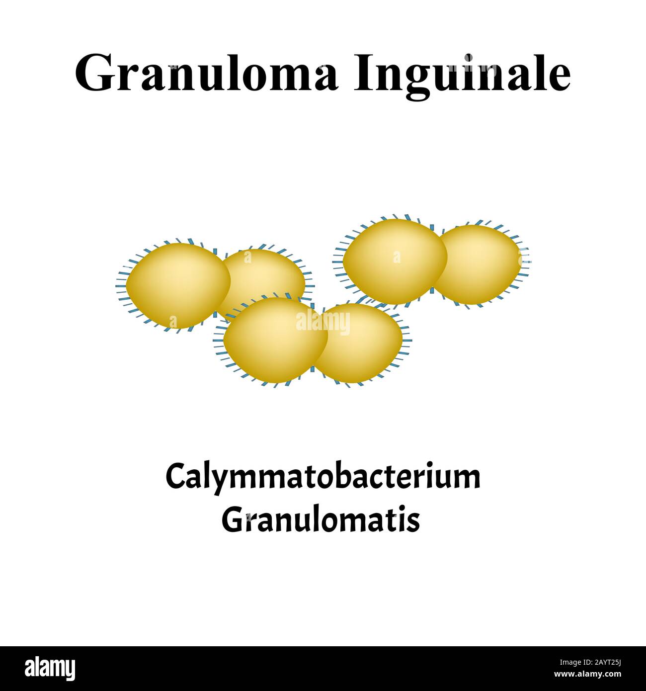 Granuloma inguinale hi-res stock photography and images - Alamy