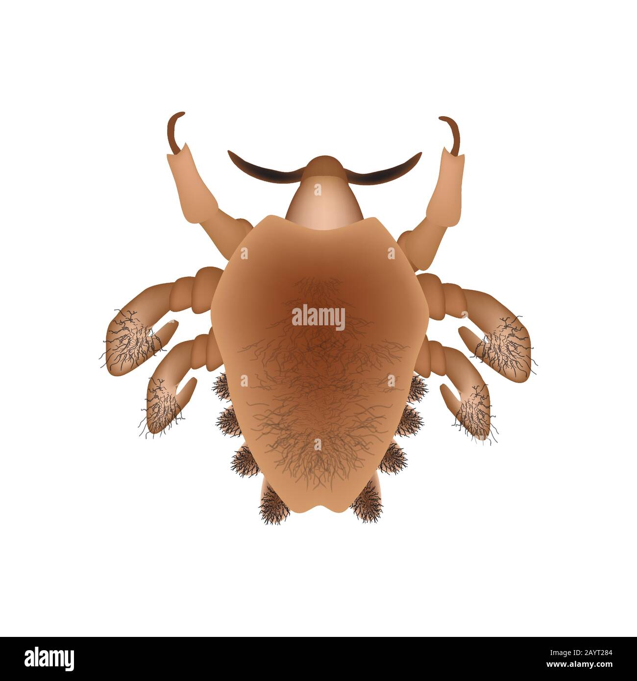 Parasitic diseases of Phthiriasis. Pediculosis pubis. Pubic lice ...