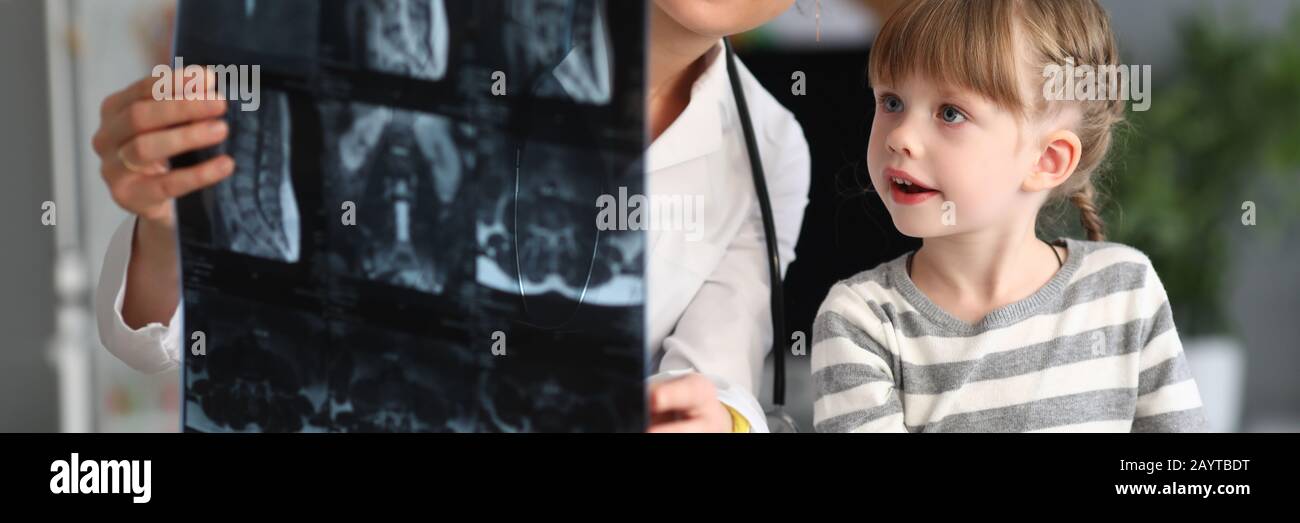 X-ray of child spine Stock Photo - Alamy