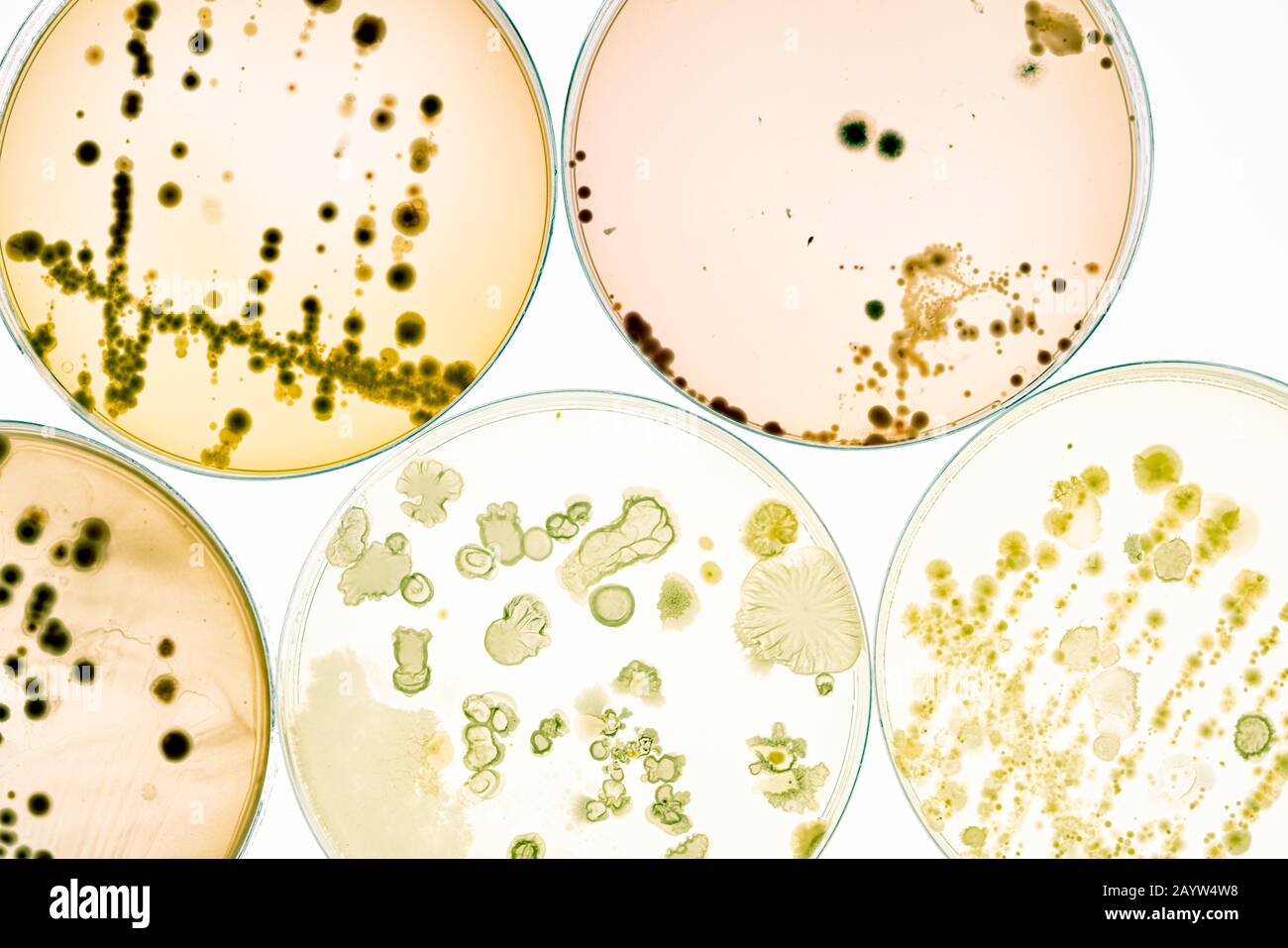 Growing Bacteria in Petri Dishes on agar gel Scientific experiment ...