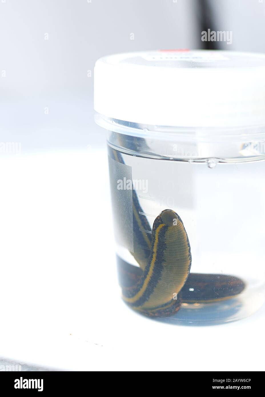 Hirudotherapy procedure, hirudotherapy, leeches as therapy, prevention ...