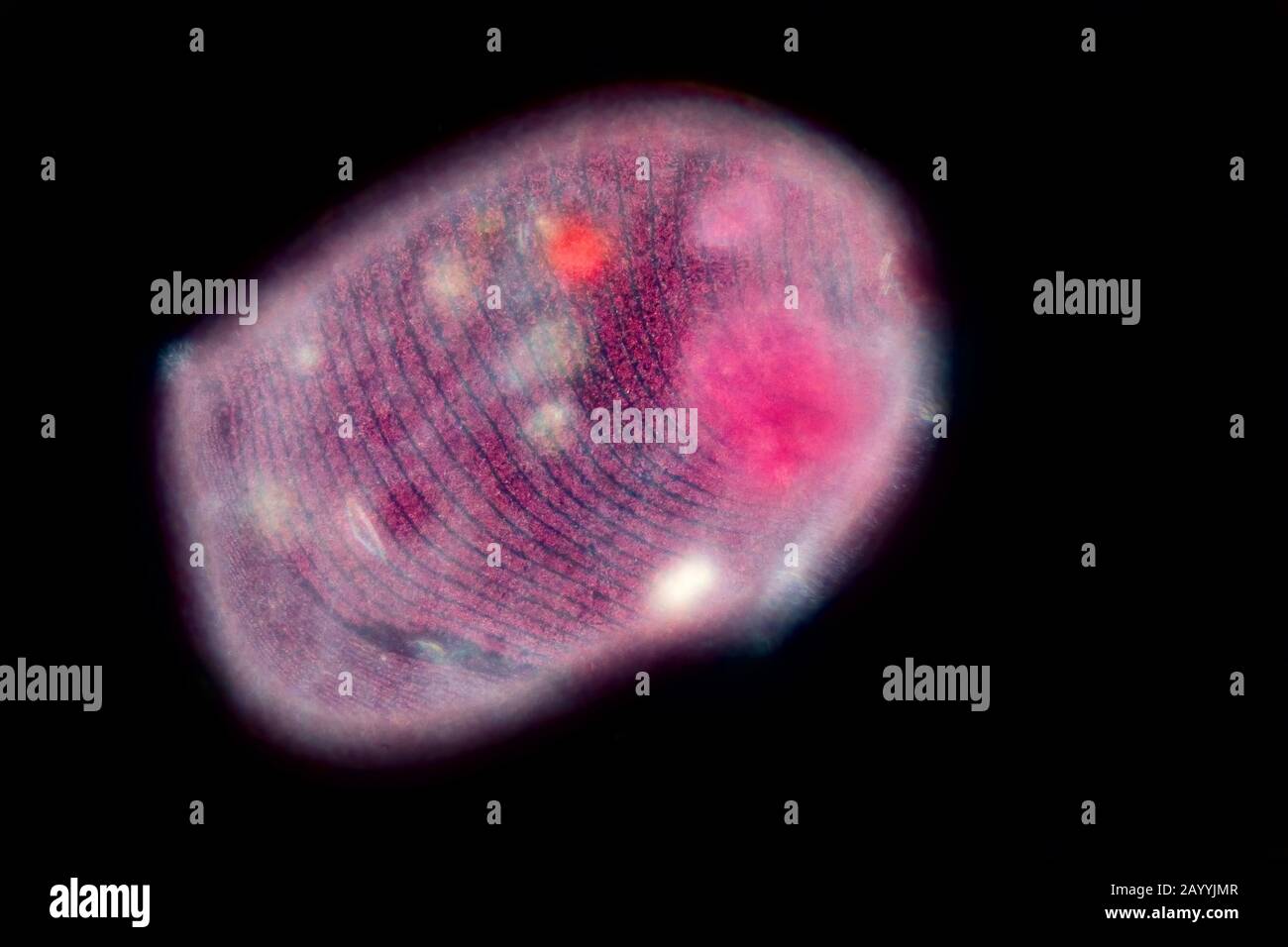 blue trumpet animalcule (Stentor coeruleus), dark-field microscope ...