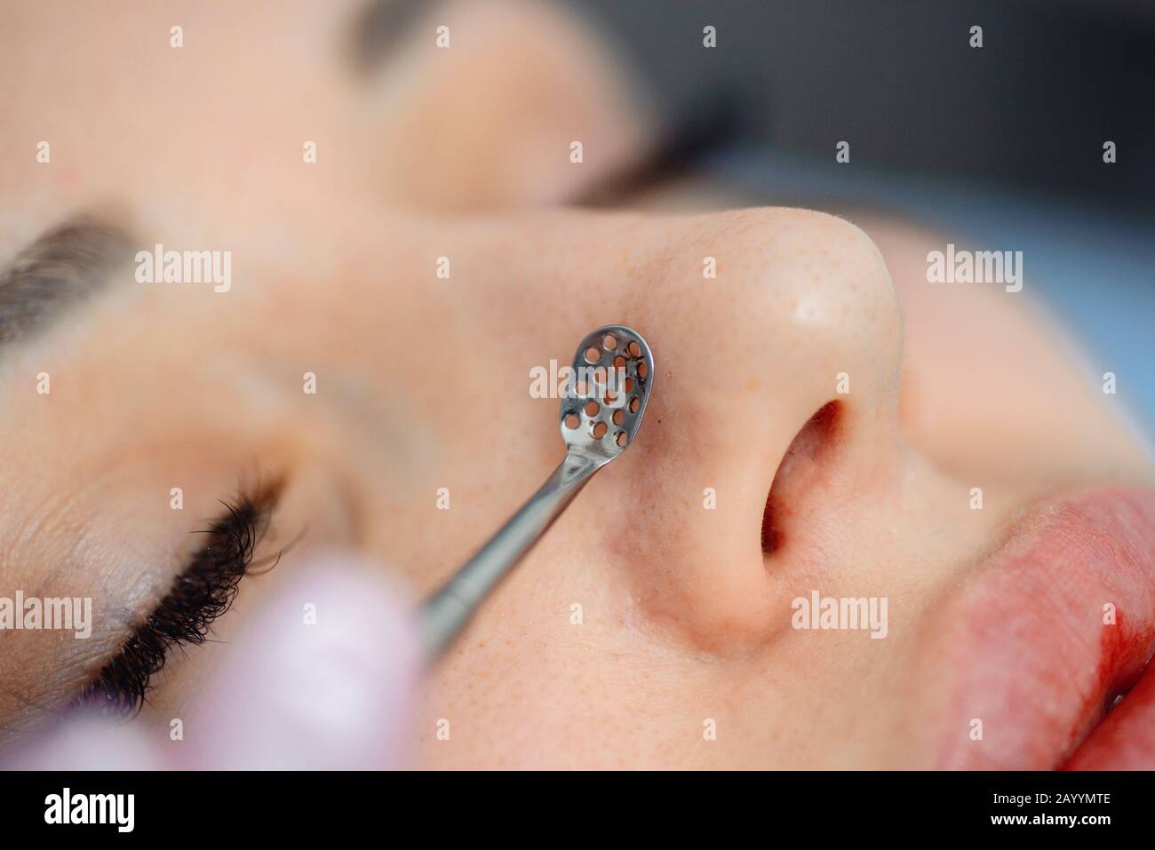 mechanical cleaning of the face around the nose patient spa salon using ...