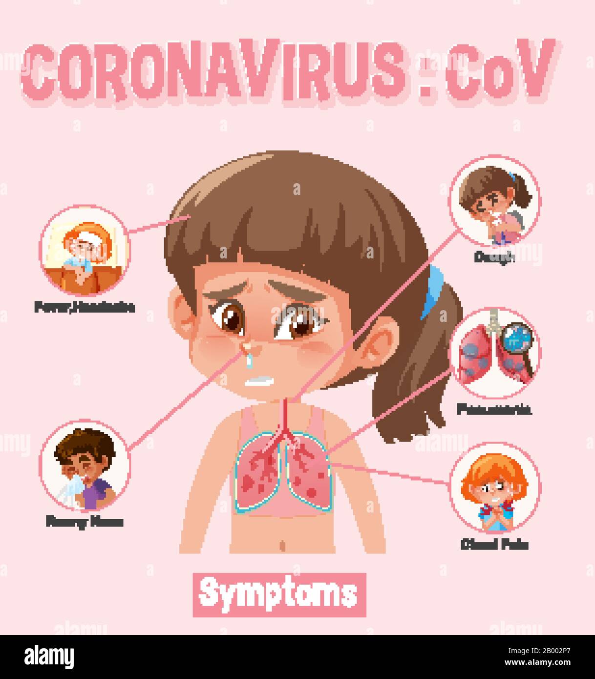 Coronavirus chart with different types of symptoms illustration Stock ...