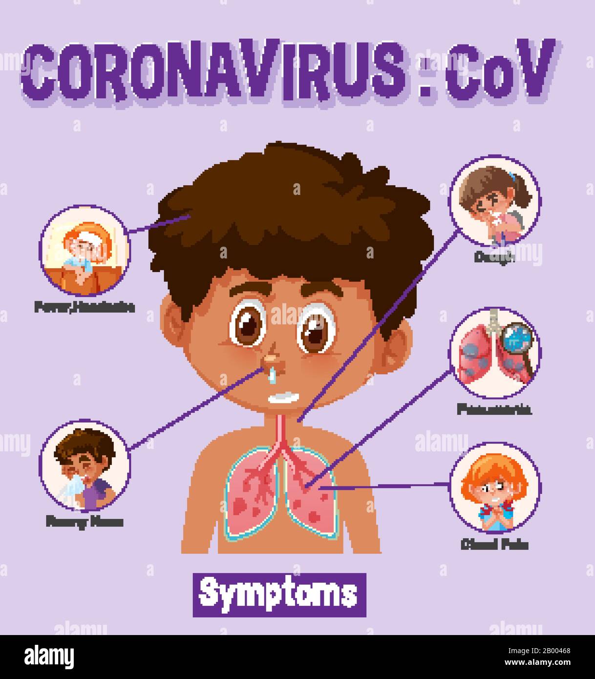 Coronavirus chart with different types of symptoms illustration Stock ...