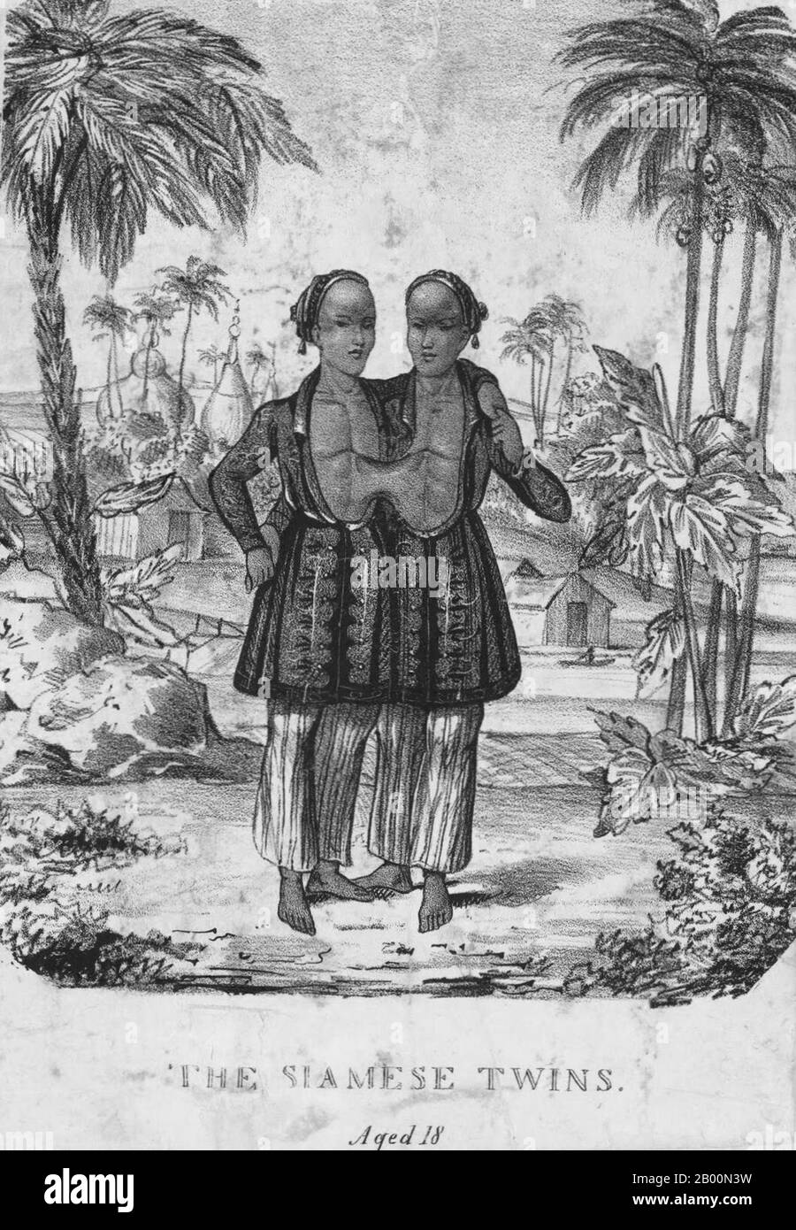 Thailand: An early engraving of the Siamese Twins Chang and Eng. The most famous pair of ...