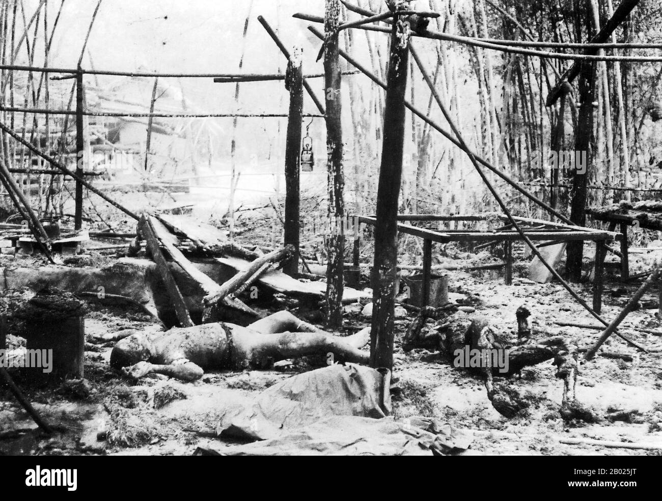 Vietnam War Napalm Victims