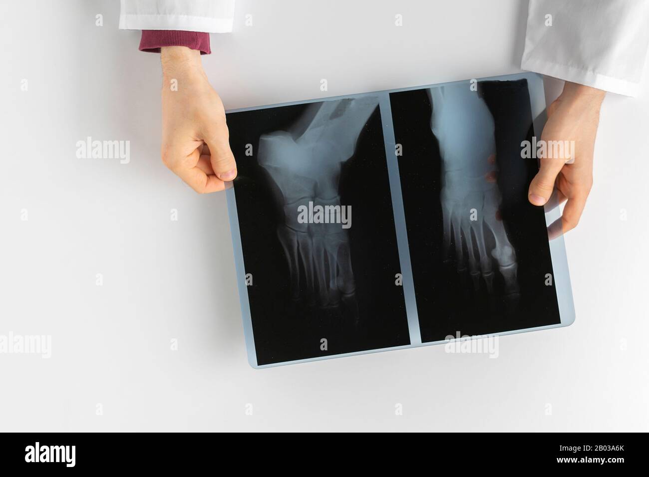 Xray scan hi-res stock photography and images - Alamy
