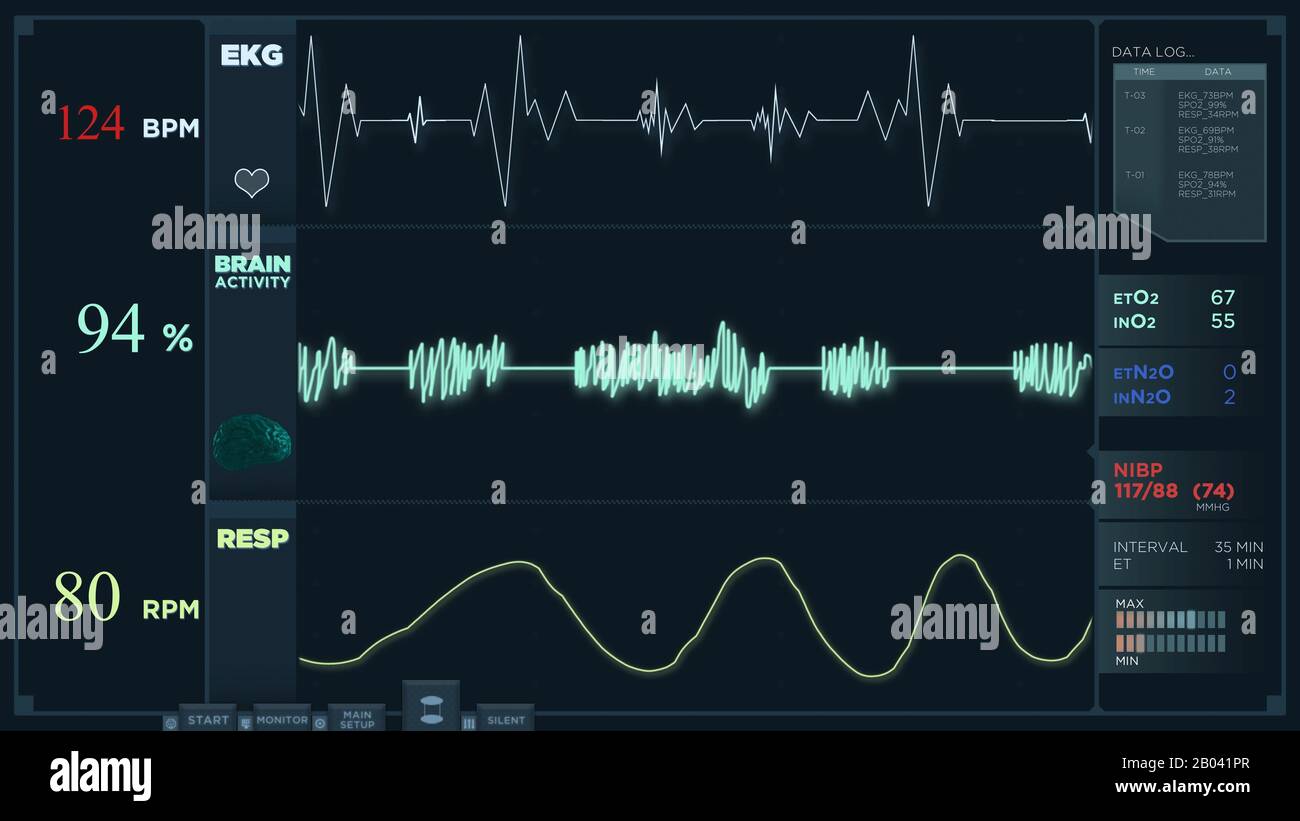 Animation of a fast electrocardiogram reading display. The heartbeats ...