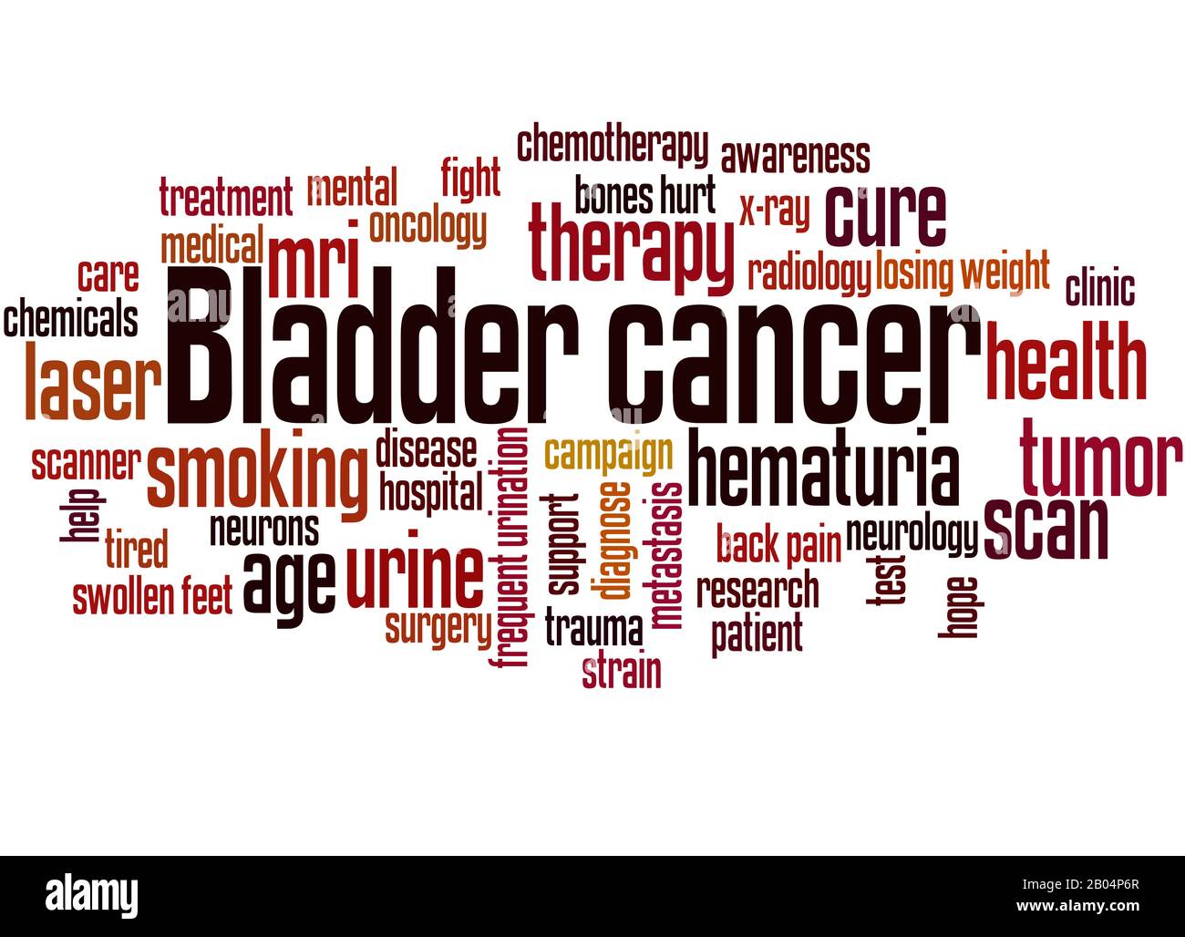 Bladder cancer word cloud concept on white background Stock Photo - Alamy