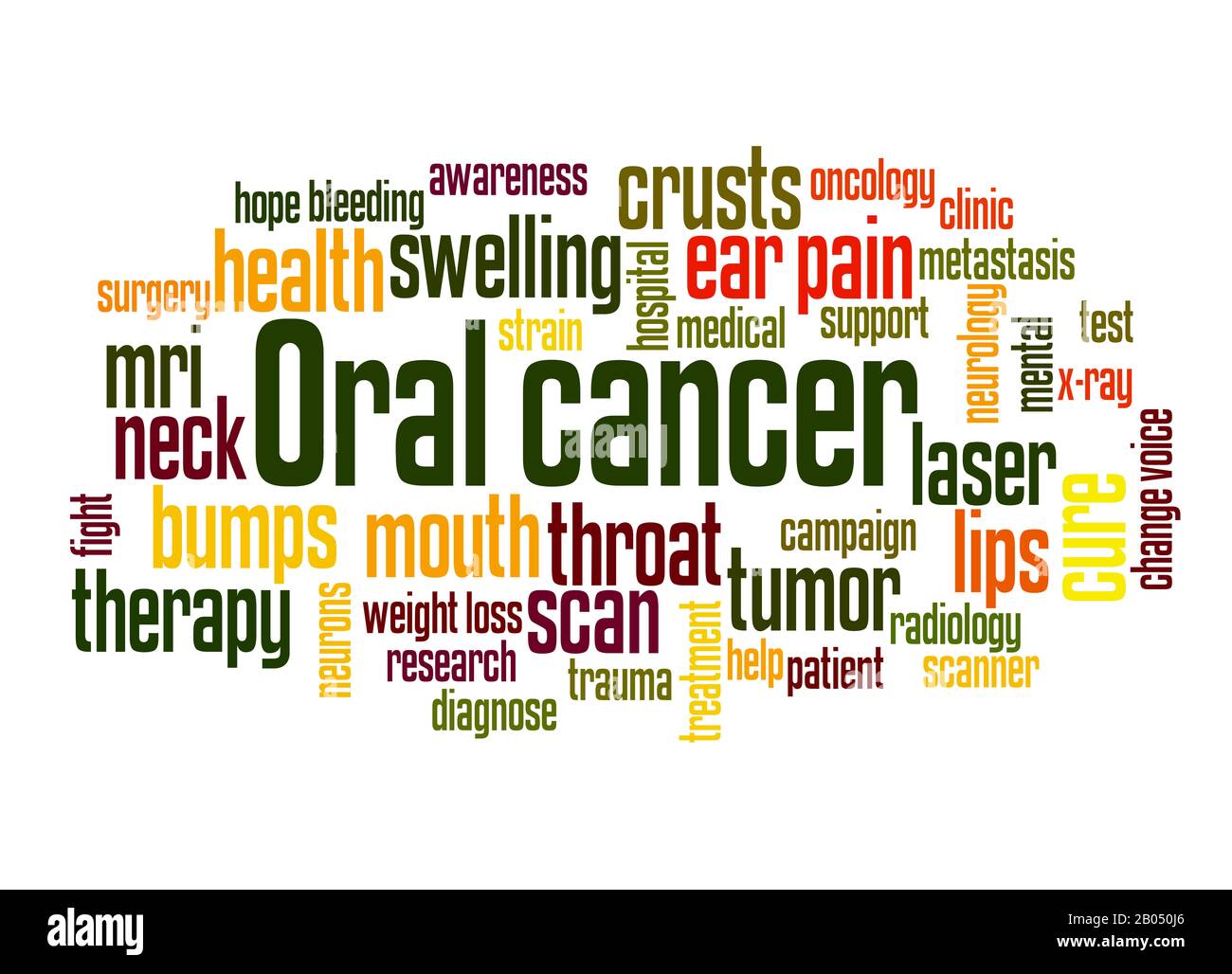 Oral cancer surgery hi-res stock photography and images - Alamy