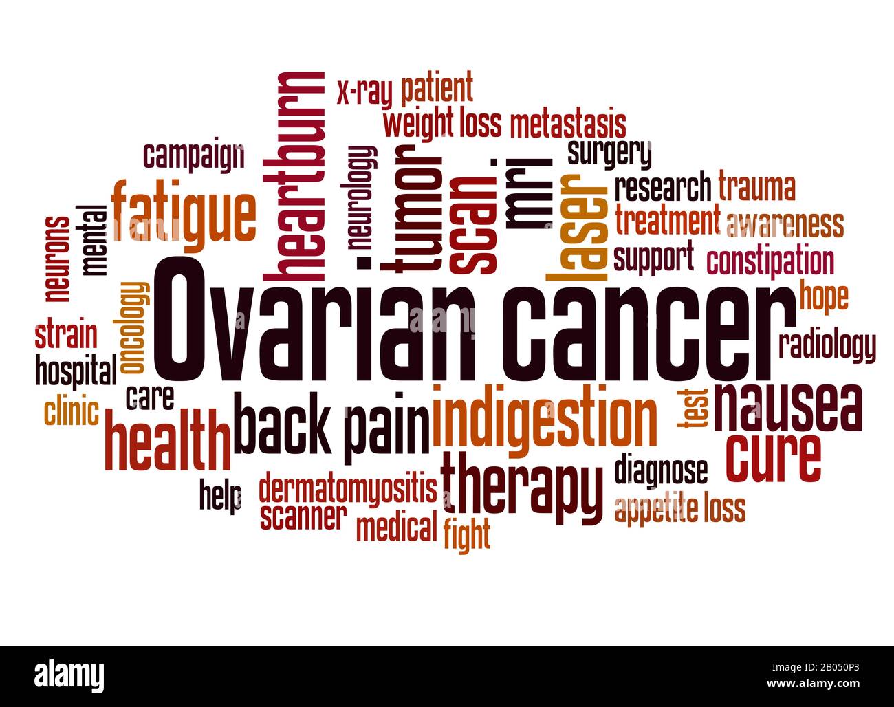 Ovarian cancer word cloud concept on white background Stock Photo - Alamy