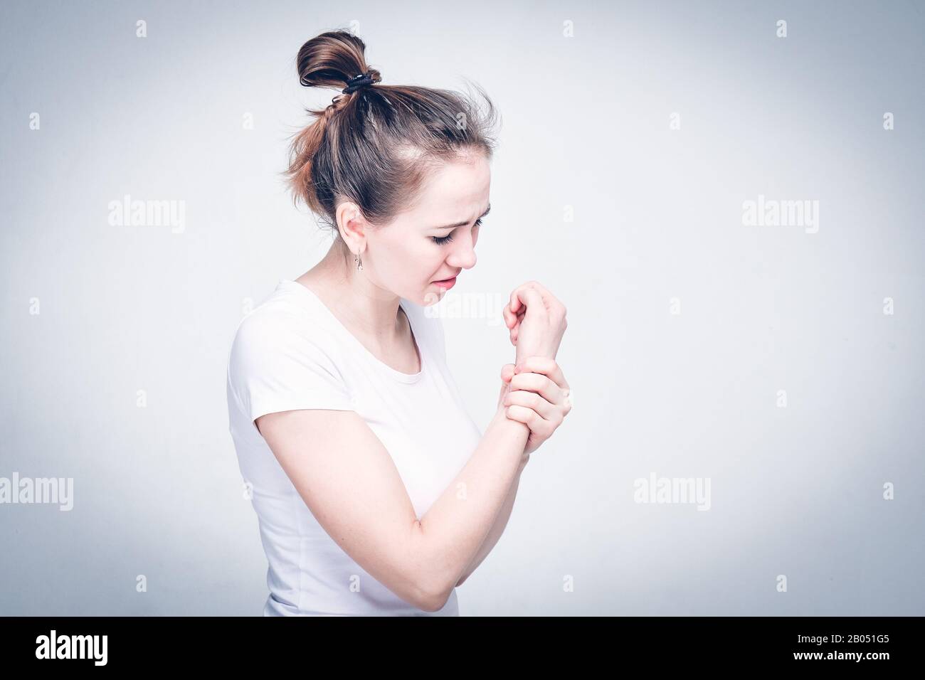 Girl bruised face hi-res stock photography and images - Alamy