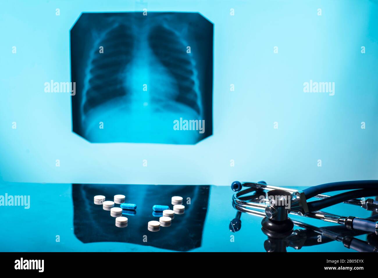 Tuberculosis treatment concept. X-ray of the lungs, with pathology ...