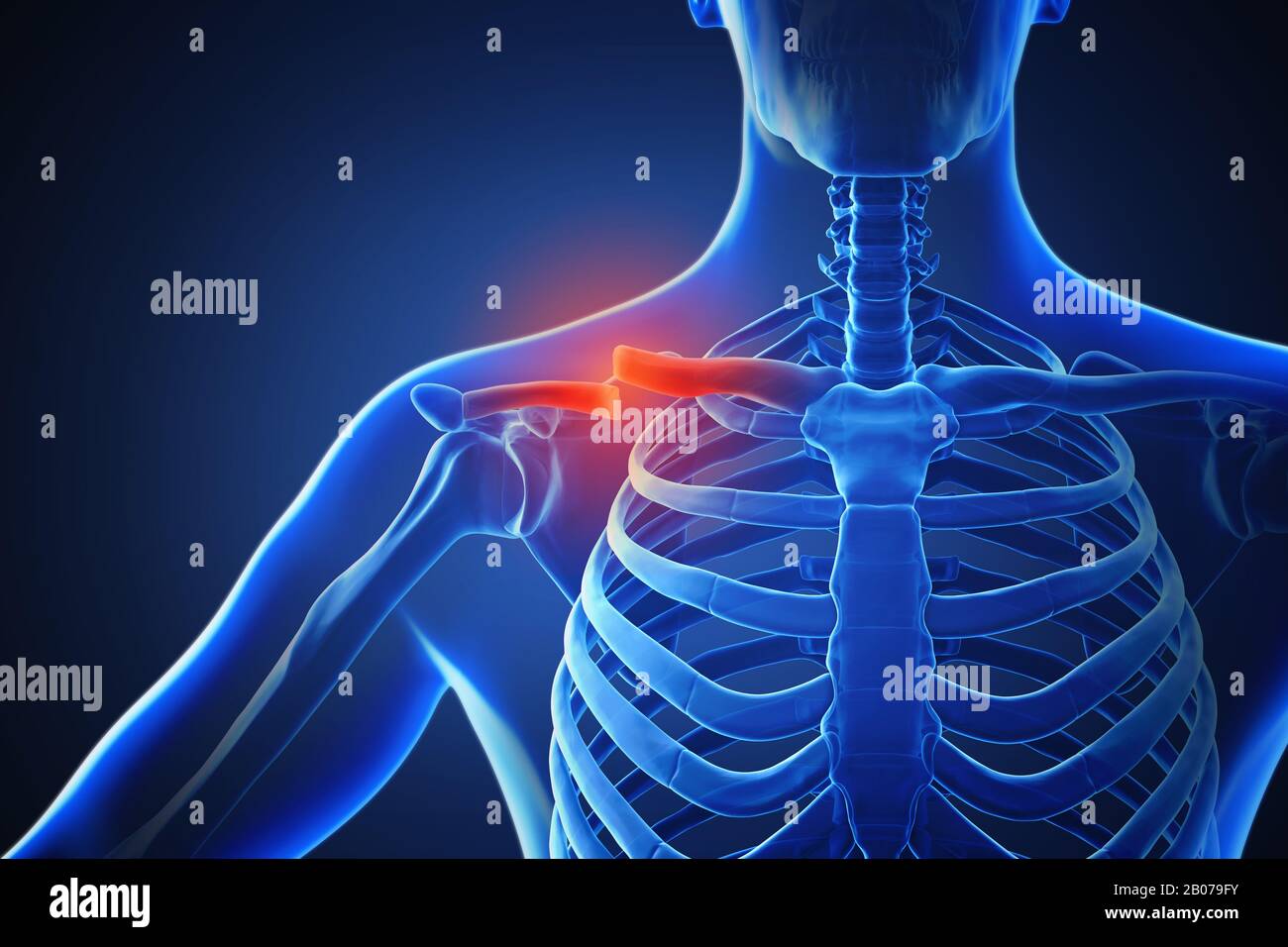 Clavicle High Resolution Stock Photography and Images - Alamy