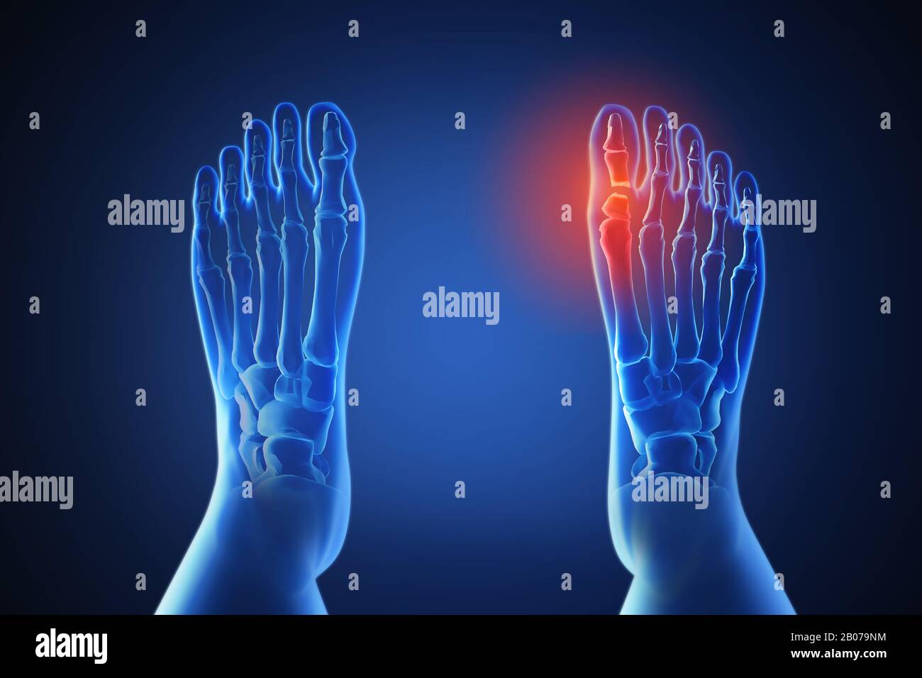 3d rendering of a human body with highlighted in pain 017 Stock Photo ...