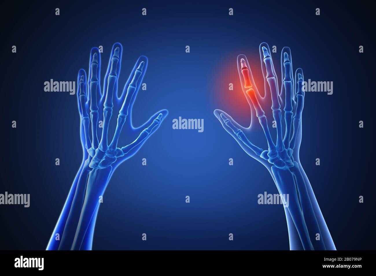 3d rendering of a human body with highlighted in pain 013 Stock Photo ...