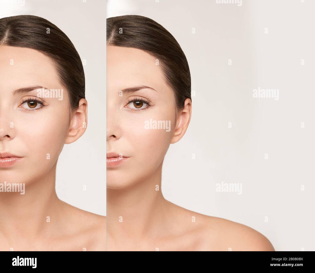 Big ear girl hi-res stock photography and images - Alamy