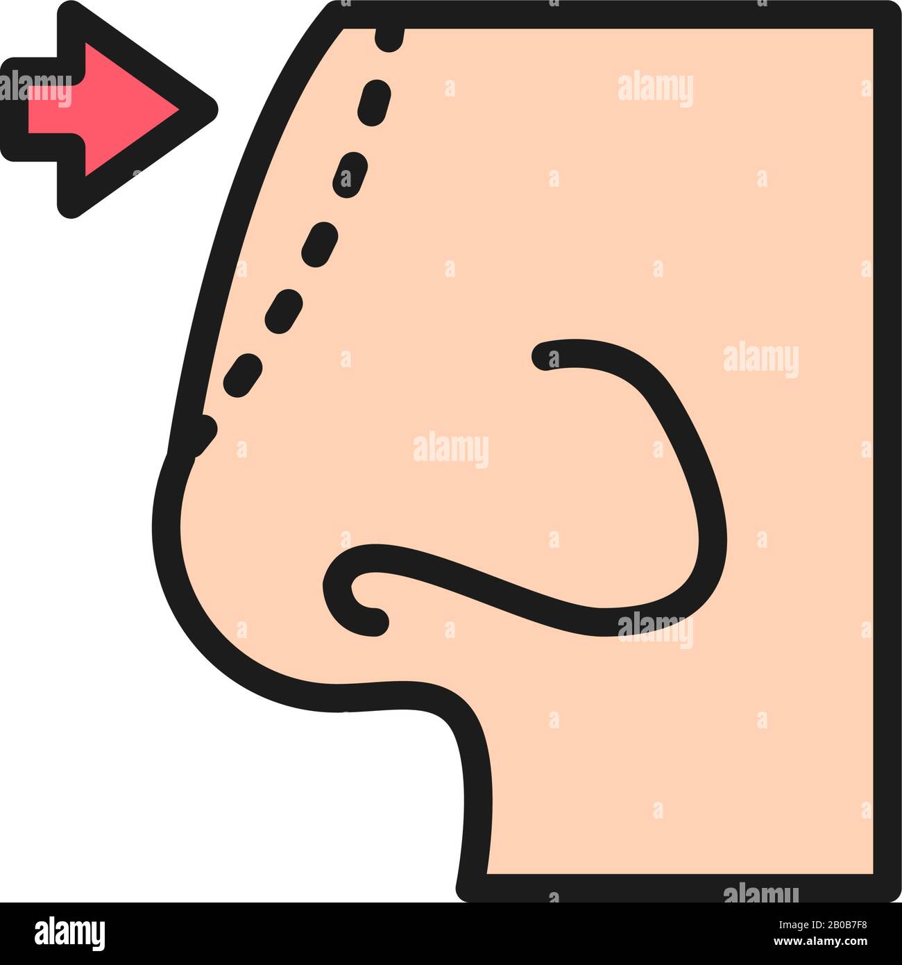 Rhinoplasty, nose plastic surgery flat color line icon Stock Vector ...