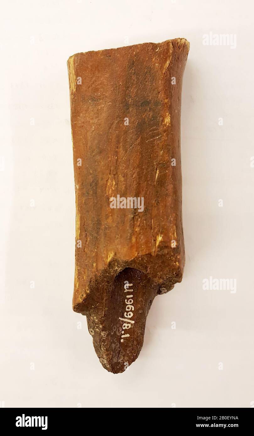 Tibia bone hi-res stock photography and images - Alamy
