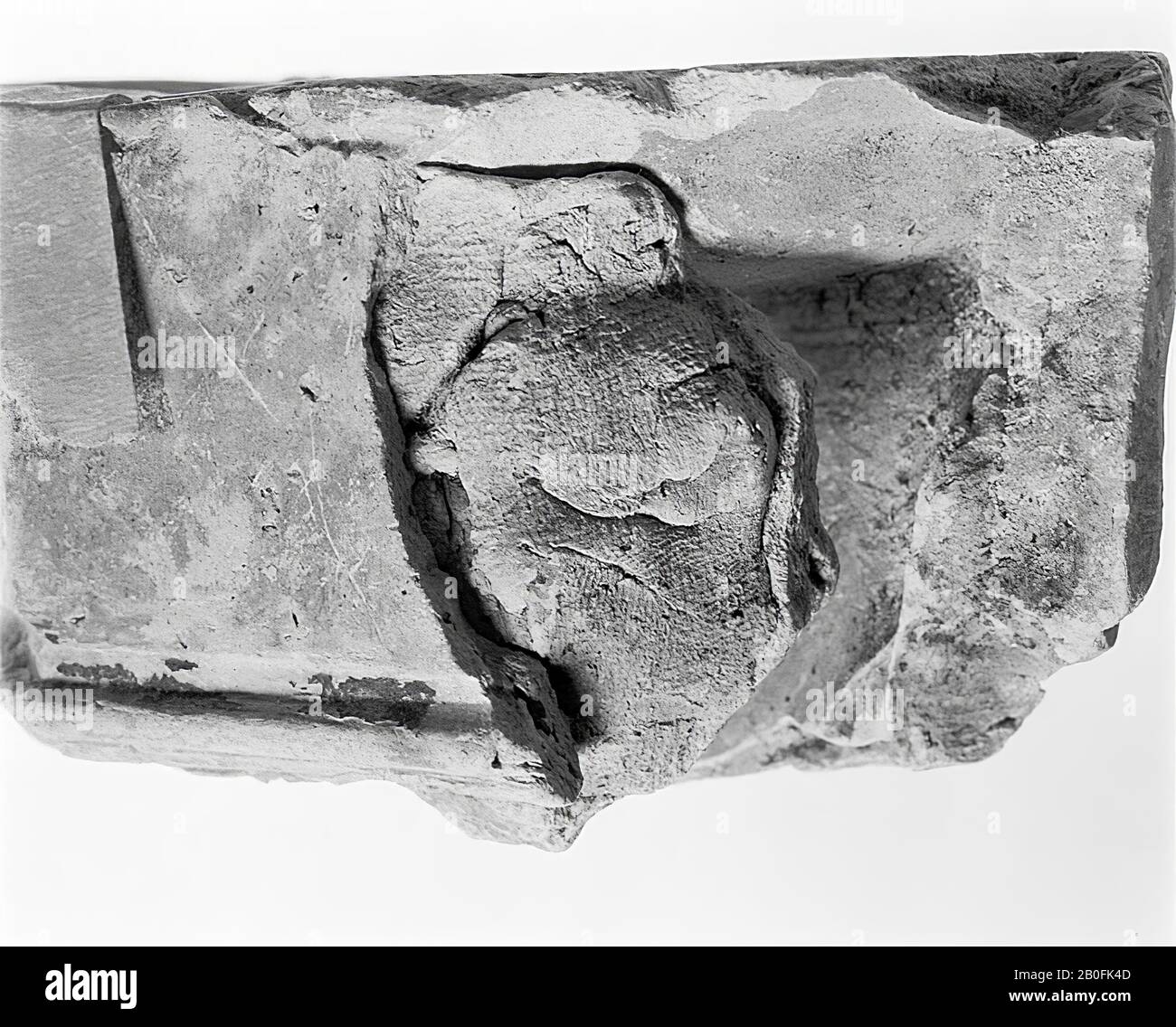 Tissue damage hi-res stock photography and images - Alamy