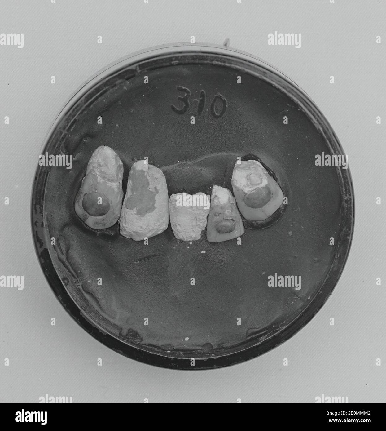 Human tooth inlaid with jadeite (one of three), Mexico, Mexico, Jadeite ...