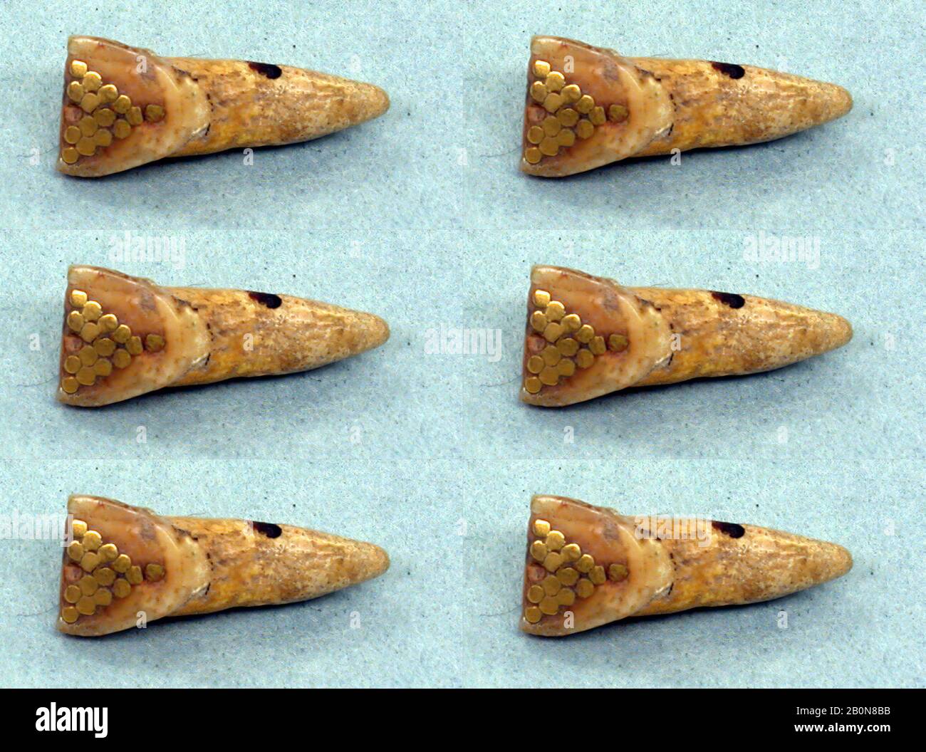 Gold Tooth High Resolution Stock Photography and Images - Alamy