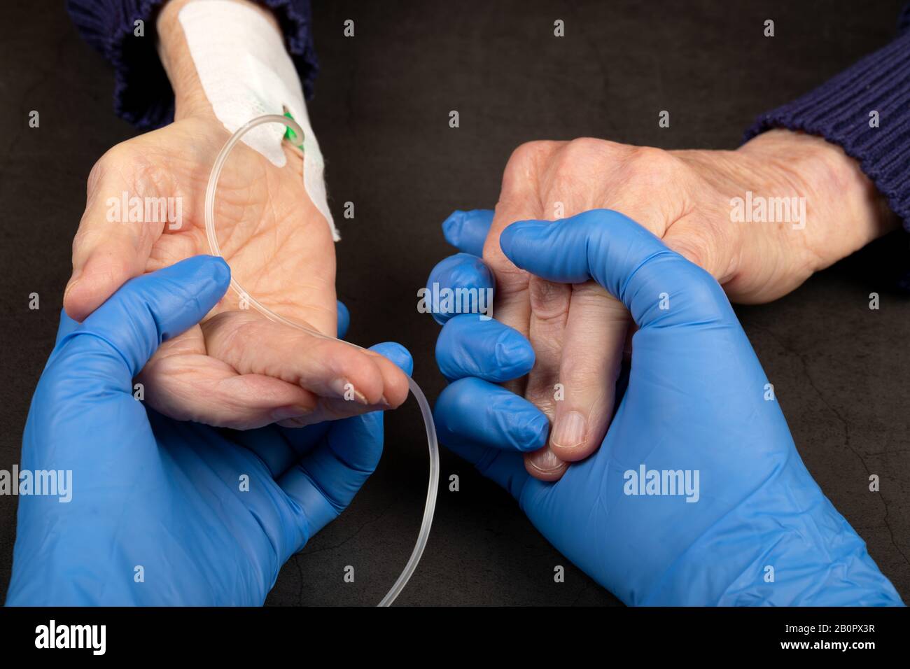 Vascular catheter hi-res stock photography and images - Alamy