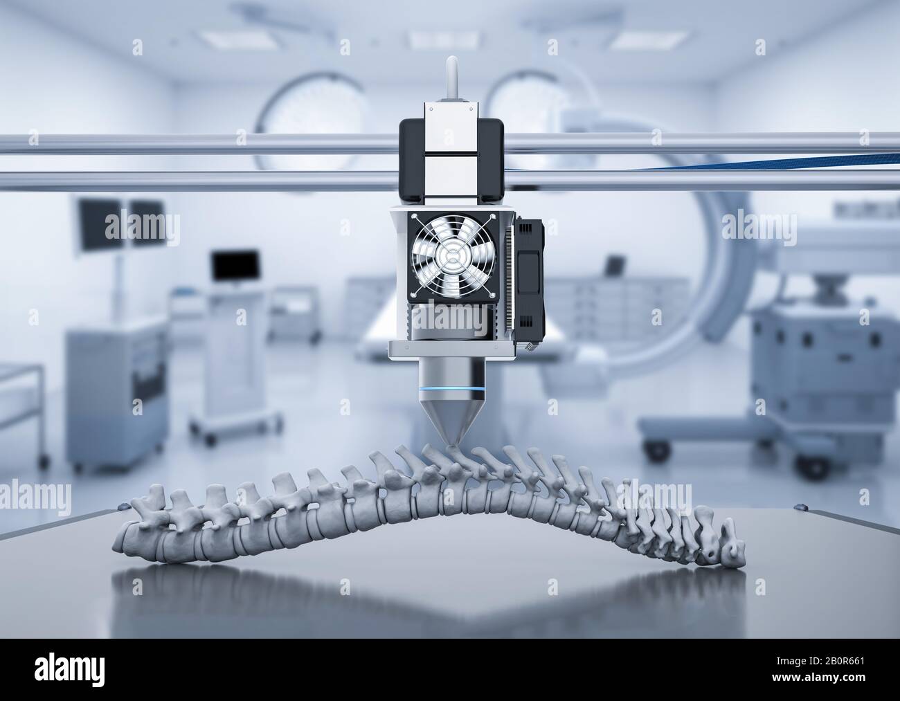 3d prosthetic spine hi-res stock photography and images - Alamy