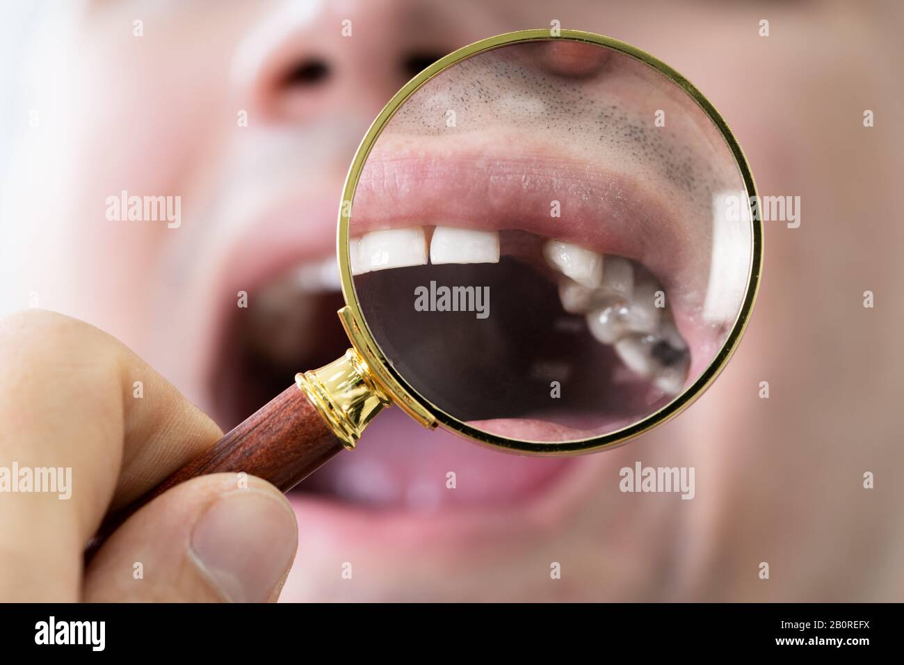 Missing teeth adult hi-res stock photography and images - Alamy