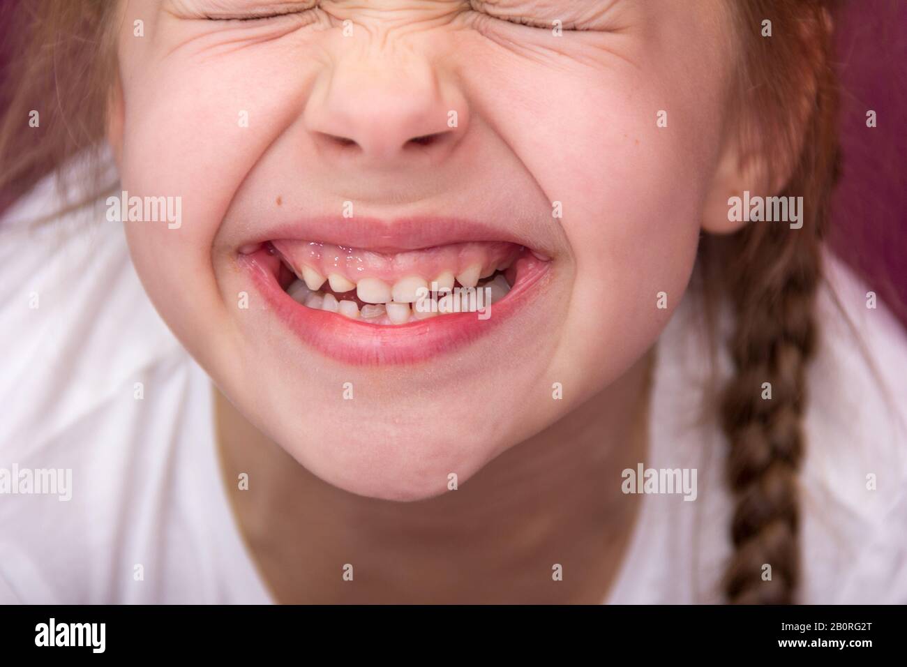 Baby teeth loss hi-res stock photography and images - Alamy