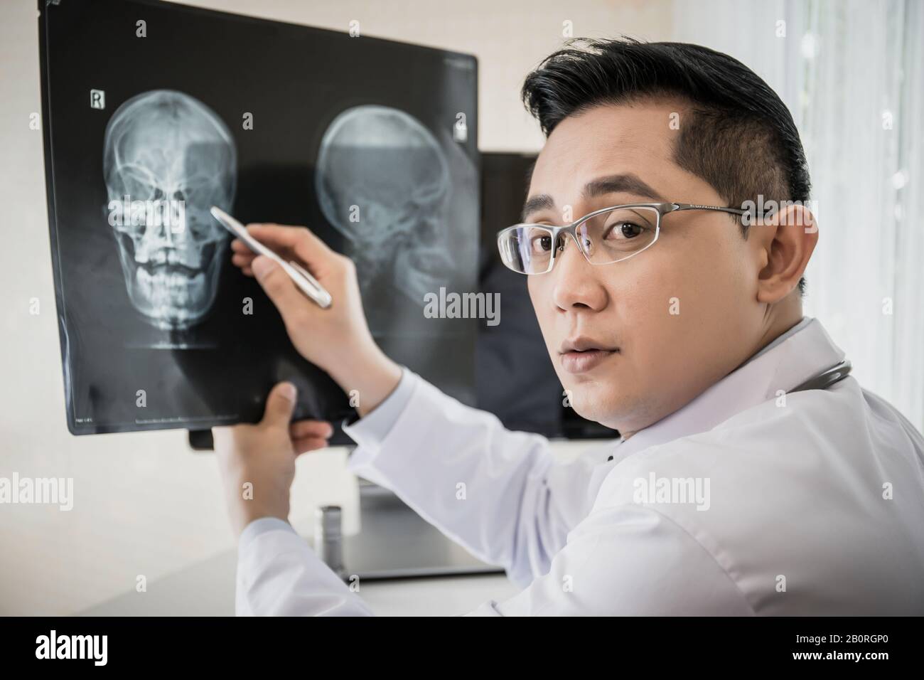 Close up of doctor holding x-ray, x-ray film of patient at hospital ...
