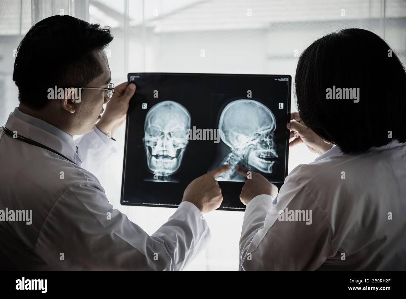 Close up of doctor holding x-ray, x-ray film of patient at hospital ...