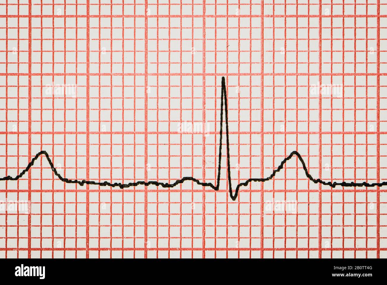 Electrocardiogram ekg hi-res stock photography and images - Alamy