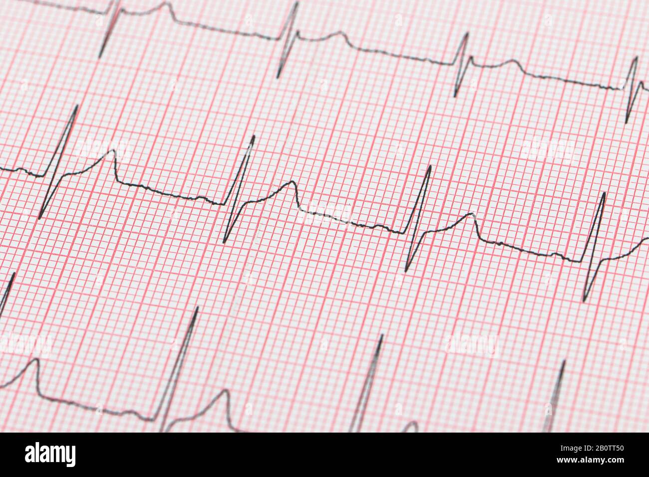 Electrocardiogram ekg hi-res stock photography and images - Alamy