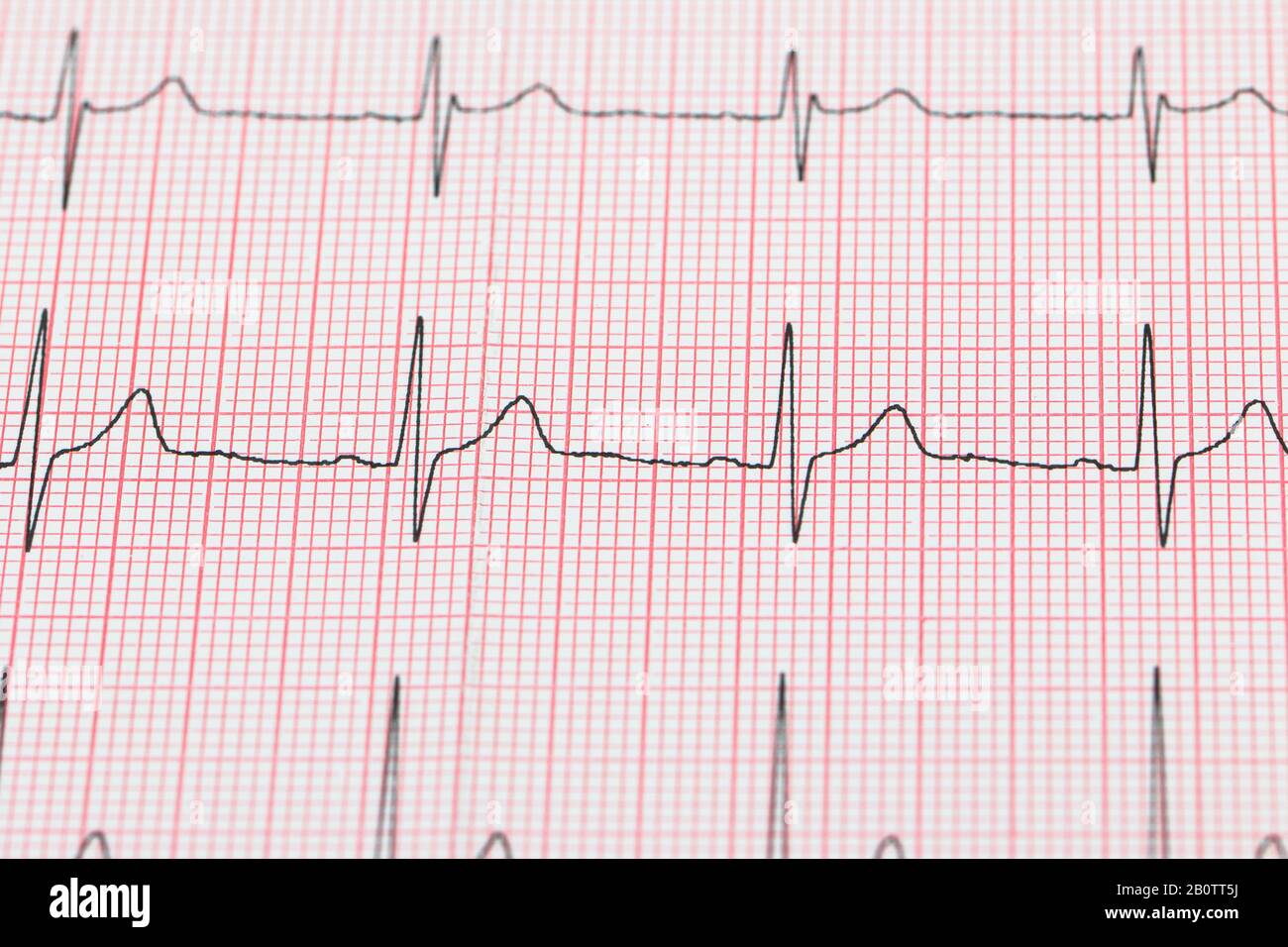 Electrocardiogram ekg hi-res stock photography and images - Alamy