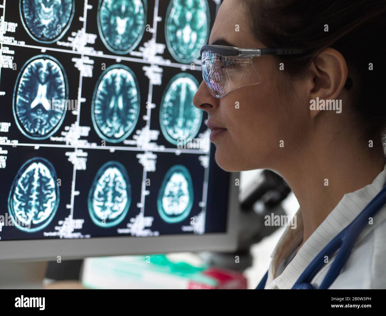 Neurology Diagnosis, Human brain scan on a screen being analysed by a ...