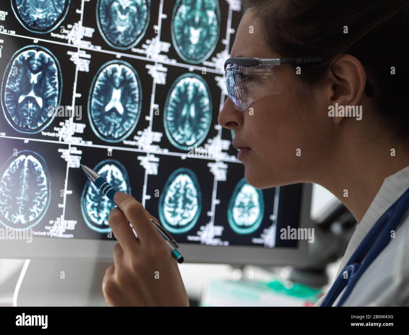 Neurology Diagnosis, Human brain scan on a screen being analysed by a ...