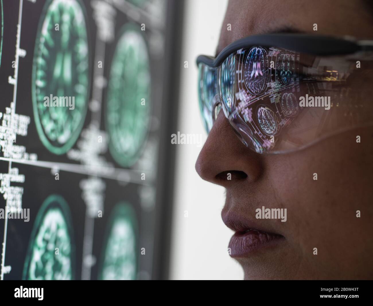 Neurology Diagnosis, Human brain scan on a screen being analysed by a ...
